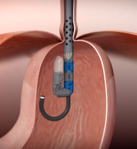 Gastroenterology Consultants of Augusta | Services